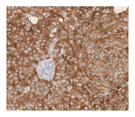 Positive Synaptophysin Staining Download Scientific Diagram