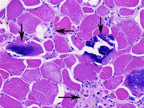 Formalin Fixed Cross Section Of Gluteal Muscle Stained With Hematoxylin