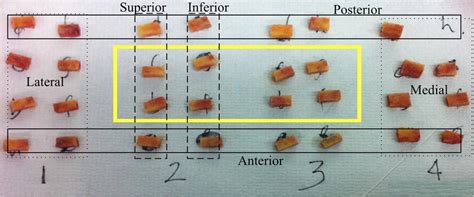 femoral heads were cut into cuboid cores for μct scanning and download scientific diagram