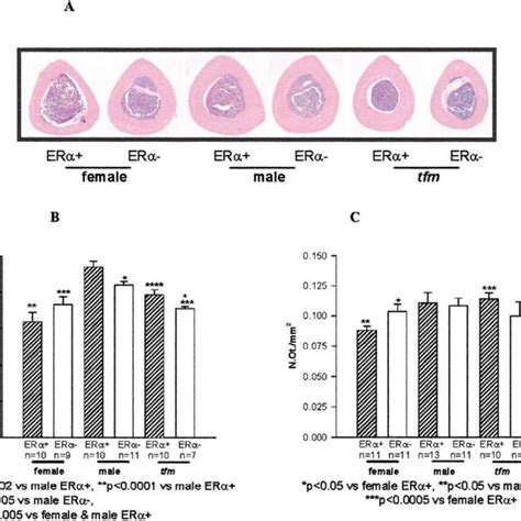 Bone Histomorphometry Of Proximal Tibia A Representative Sections Of
