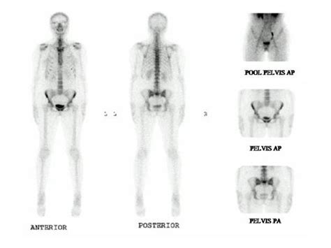 Skeletal System Imaging