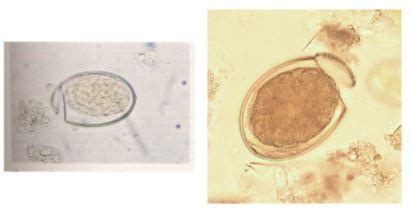 Tapeworm Pictures Flashcards Quizlet