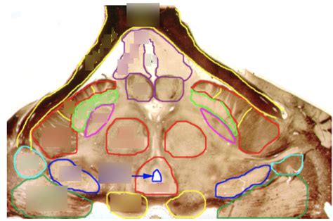 Neuro Transition Of Midbrain To Diencephalon Diagram Quizlet