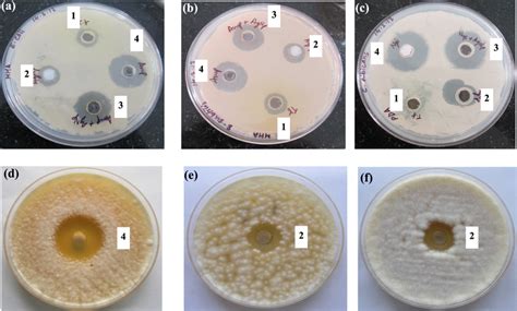 Clear Agar Plate At Sandra Madrigal Blog