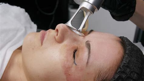 Fractional Co2 Laser Vs Other Skin Treatments In Dubai