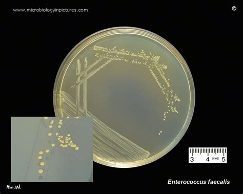 Enterococcus Faecalis On Cled Agar Colony Appearance Of Enterococci On