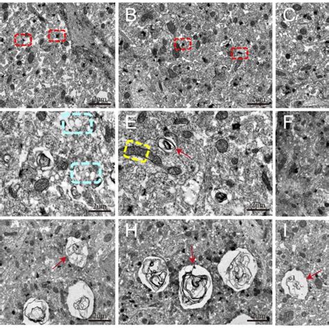 Transmission Electron Microscopy Observation Of Cell Morphology Red