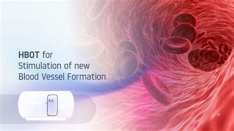 Hyperbaric Oxygen Therapy Catalyzing New Blood Vessel Formation For