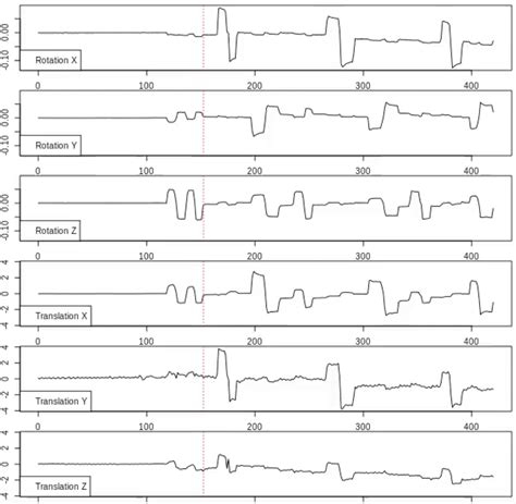 Mri Autoencoder