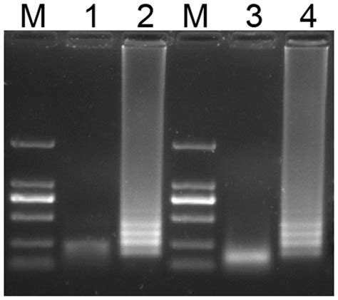 Gel Electrophoresis Results For Psr Products Prior And After Download Scientific Diagram
