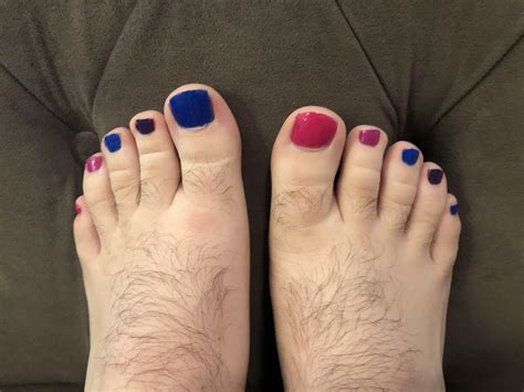 What Causes Hairy Feet At Isabella Embry Blog
