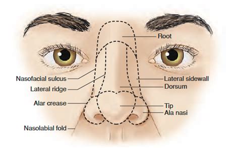 Excision Lesions On The Nose And Reconstruction Of Surgical Defects