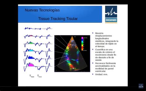 Tissue Tracking Tisular Digimed Ultrasonido