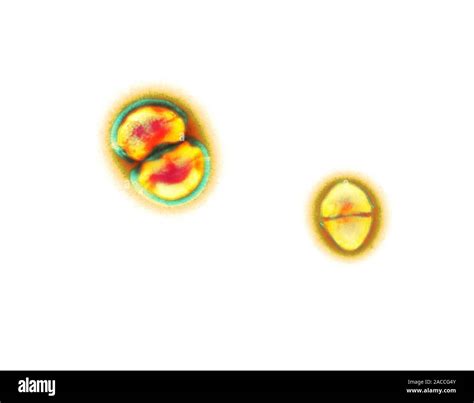 Streptococcus Oral Bacteria Coloured Transmission Electron Micrograph