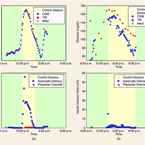 Clinical Results Of A Fully Automated Closed Loop Control From A