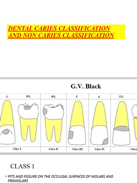 Dental Caries Classification And Non Carious Lesion Final Pdf