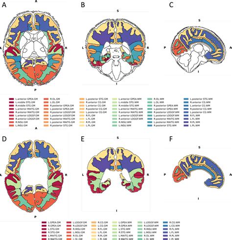 Drawem Neonatal Brain Segmentation Visualisation Of The Brain Regions Download Scientific