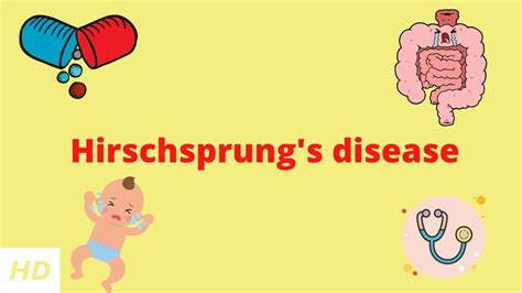 Hirschsprungs Disease Causes Signs And Symptoms Diagnosis And