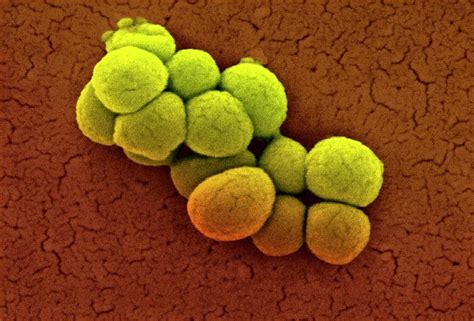 Micrococcus Luteus Bacteria 1 Photograph By Science Photo Library Pixels Merch