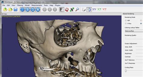Top Open Source Free DICOM Viewers For Medical Professionals