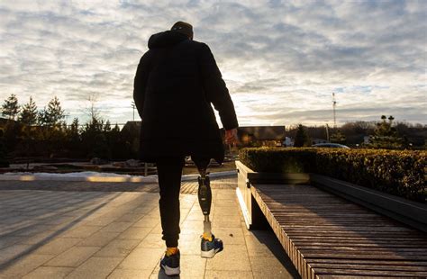 Українці які втратили кінцівки під час війни зможуть безплатно отримати протези в Естонії Zmina