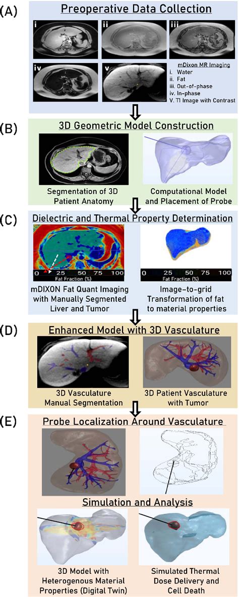 Figure 1 From Simulation Of Image Guided Microwave Ablation Therapy