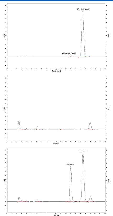 Figure 2 From Development And Validation Of A Simple And Isocratic