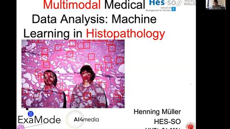 Underline Mmdlca Multi Modal Deep Learning Challenges And Applications