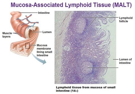 Mucosa Associated Lymphoid Tissue