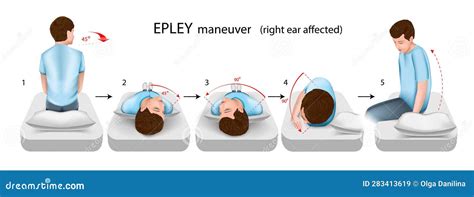 Epley Maneuver Right Ear Affected Vector Illustration Stock Vector Illustration Of Balance
