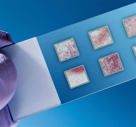 Solid Tumors Ohsu Knight Diagnostic Laboratories