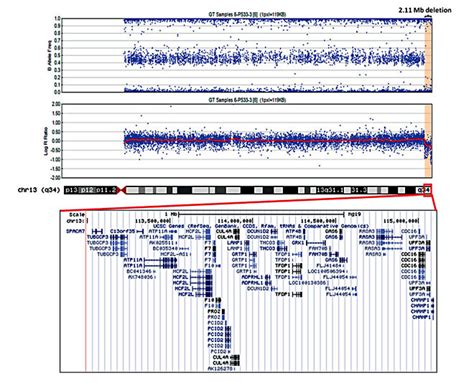 An Snp Microarray Showing A Deletion Of The Chromosome 13q34 Region As