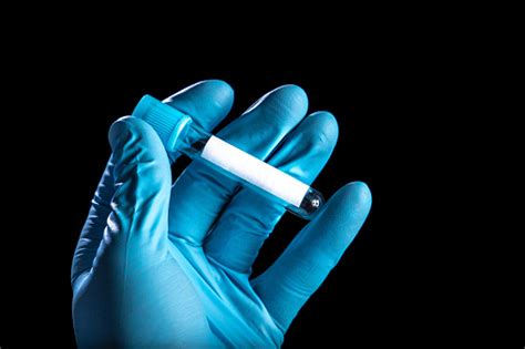 고무 의료용 장갑을 낀 실험실 조교의 손에 있는 분석을 위한 실험실 시험관 건강관리와 의술에 대한 스톡 사진 및 기타 이미지 건강관리와 의술 검정색 배경 과학