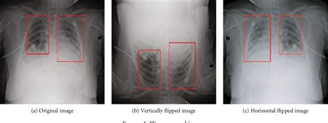 figure 1 from pneumonia detection using an improved algorithm based on faster r cnn semantic