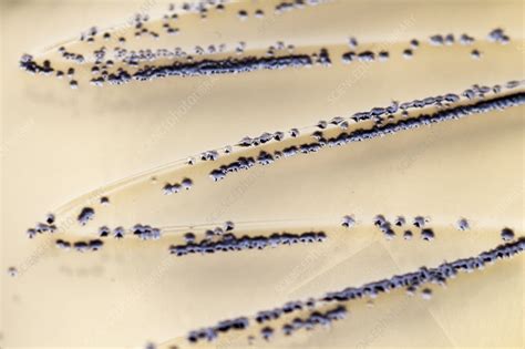 Clostridioides Difficile Bacteria Culture Stock Image C029 1371 Science Photo Library