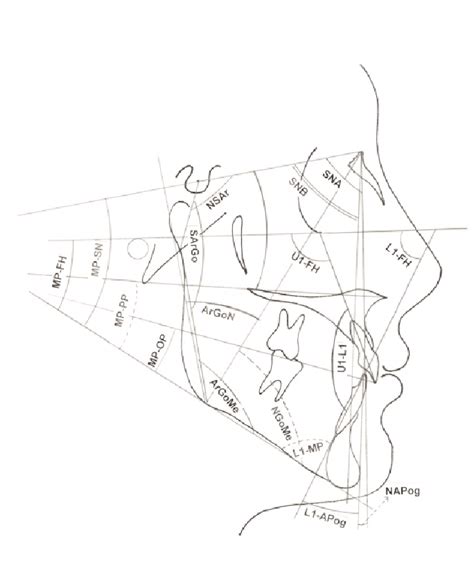 Skeletal And Dental Angular Measurements Download Scientific Diagram