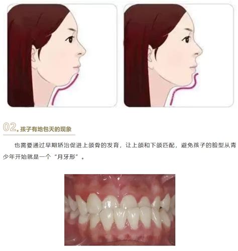 分部动态总院正畸专家赴苏口吴江分门诊长期坐诊啦 医院动态 苏州口腔医院