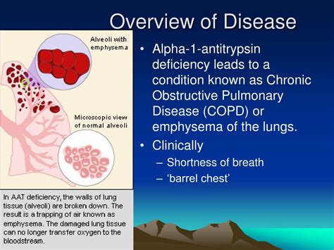 Ppt Alpha 1 Antitrypsin Deficiency Powerpoint Presentation Free