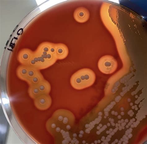 Staphylococcus Aureus This Is The Most Dangerous Of All Of The Many