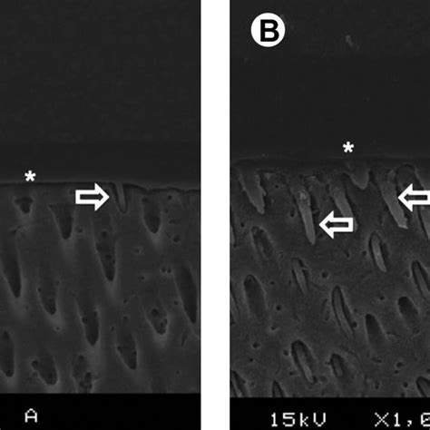 Pdf Self Etch Adhesive Systems A Literature Review
