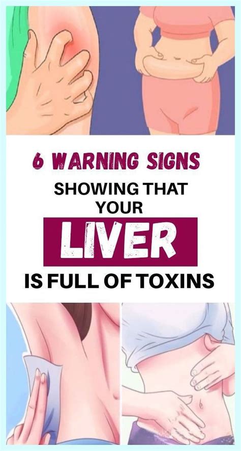 Top Notch Tips En 2024