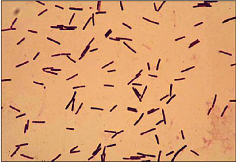 Gram Staining Of Clostridium Difficile Download Scientific Diagram