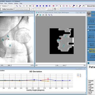Sequencereg User Interface Showing Template Registration To Mv And Kv Download Scientific