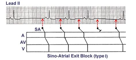 Ecg Learning Center An Introduction To Clinical Electrocardiography