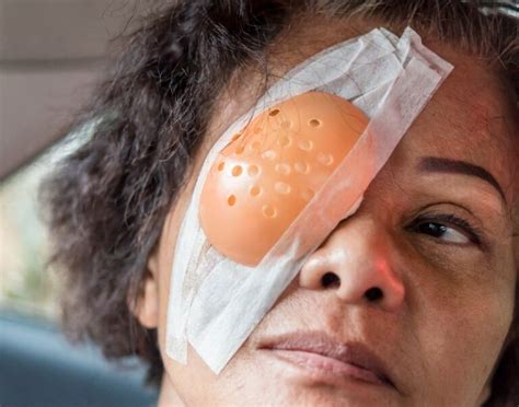 Secondary Cataract Meaning Causes Diagnosis And Prevention