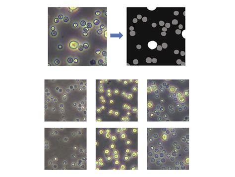 Researchers Found A New Ml Method Capable Of Counting Cells For Disease
