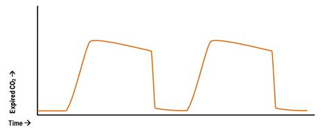 Abnormal Capnography Waveforms And Their Interpretation Deranged