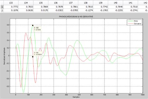 Github Kevinmgamboas1 S1 Phonocardiogram Peak Detection Method In Python