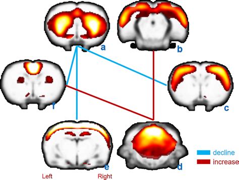 Pni‐related Differences In Brain Functional Network Connectivity Download Scientific Diagram