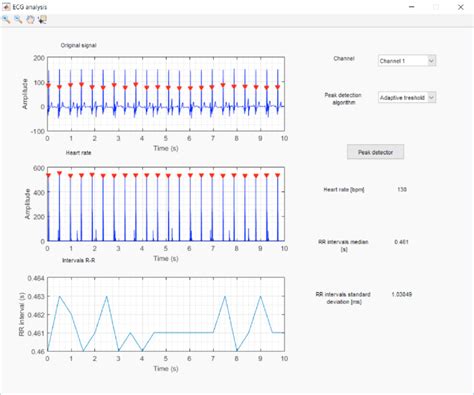 Example Of The Analysis Block Peak Detector Download Scientific Diagram